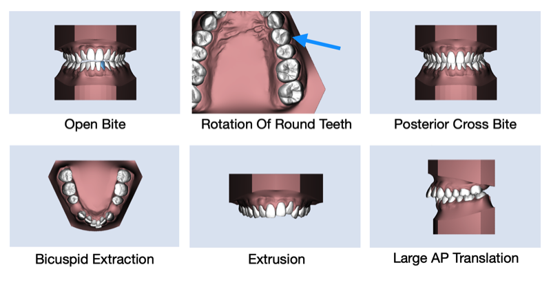 Swipe To See Difficult